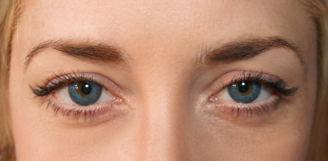 Eyesight Requirements For Driving In New Zealand